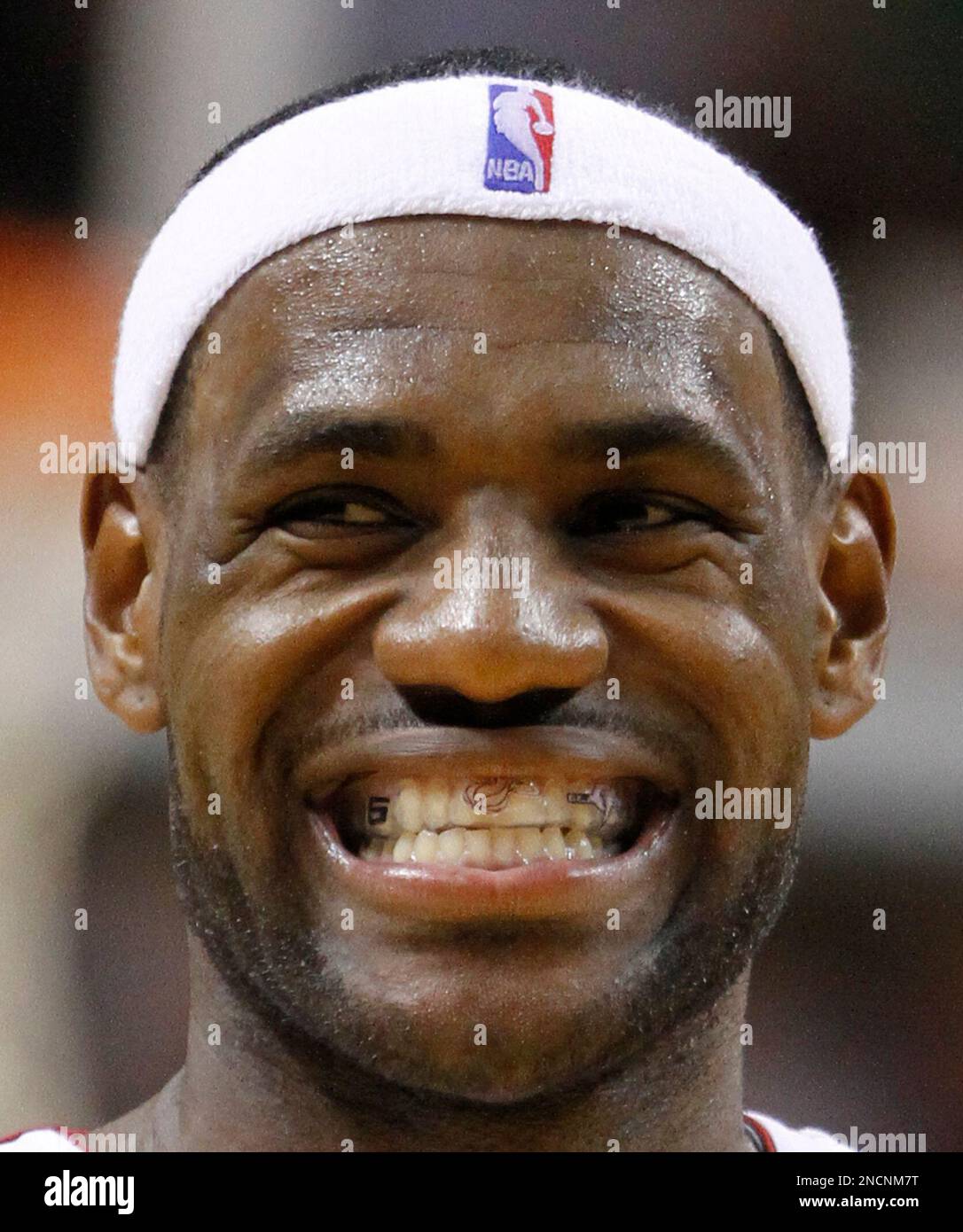 Lebron James Teeth LeBron James LeBron James Added A New Photo.