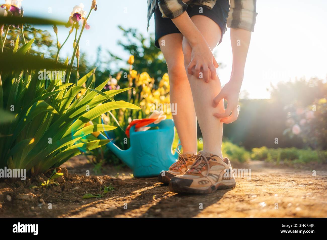 Woman scratches her leg, which is itchy from a mosquito bite. Close up ...