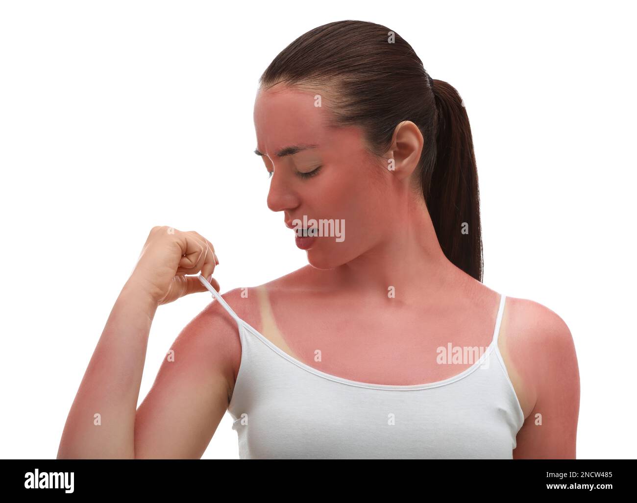 Woman sore skin beach hi-res stock photography and images - Alamy