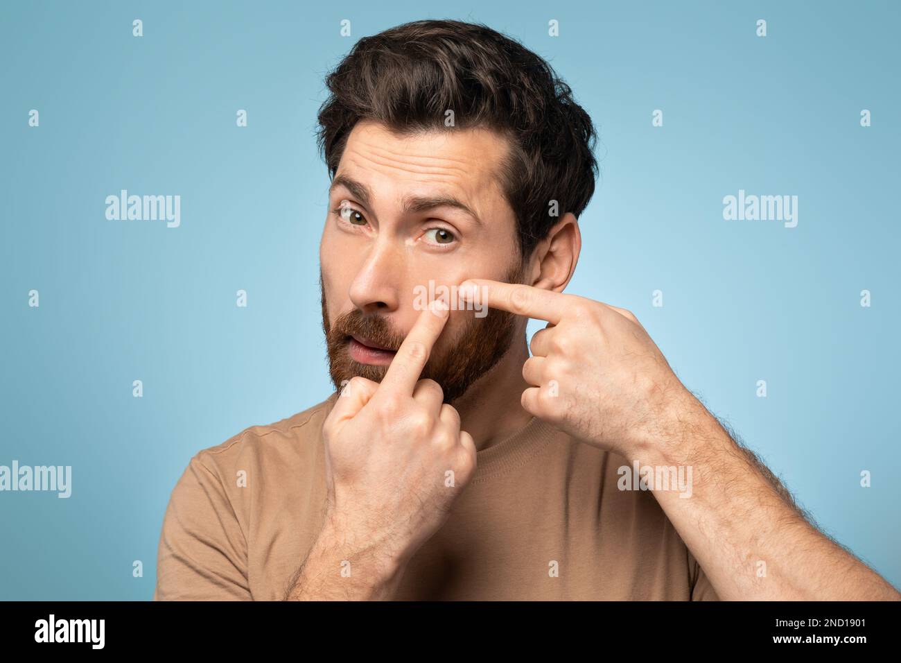 Middle aged man removing pimple from face, looking at camera while ...