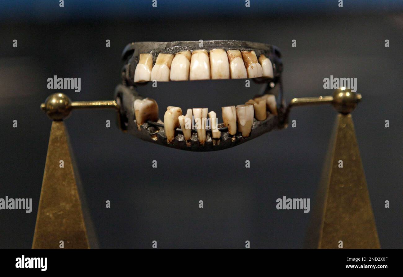 In this Thursday, Sept. 9, 2010 photo, dentures worn by George ...