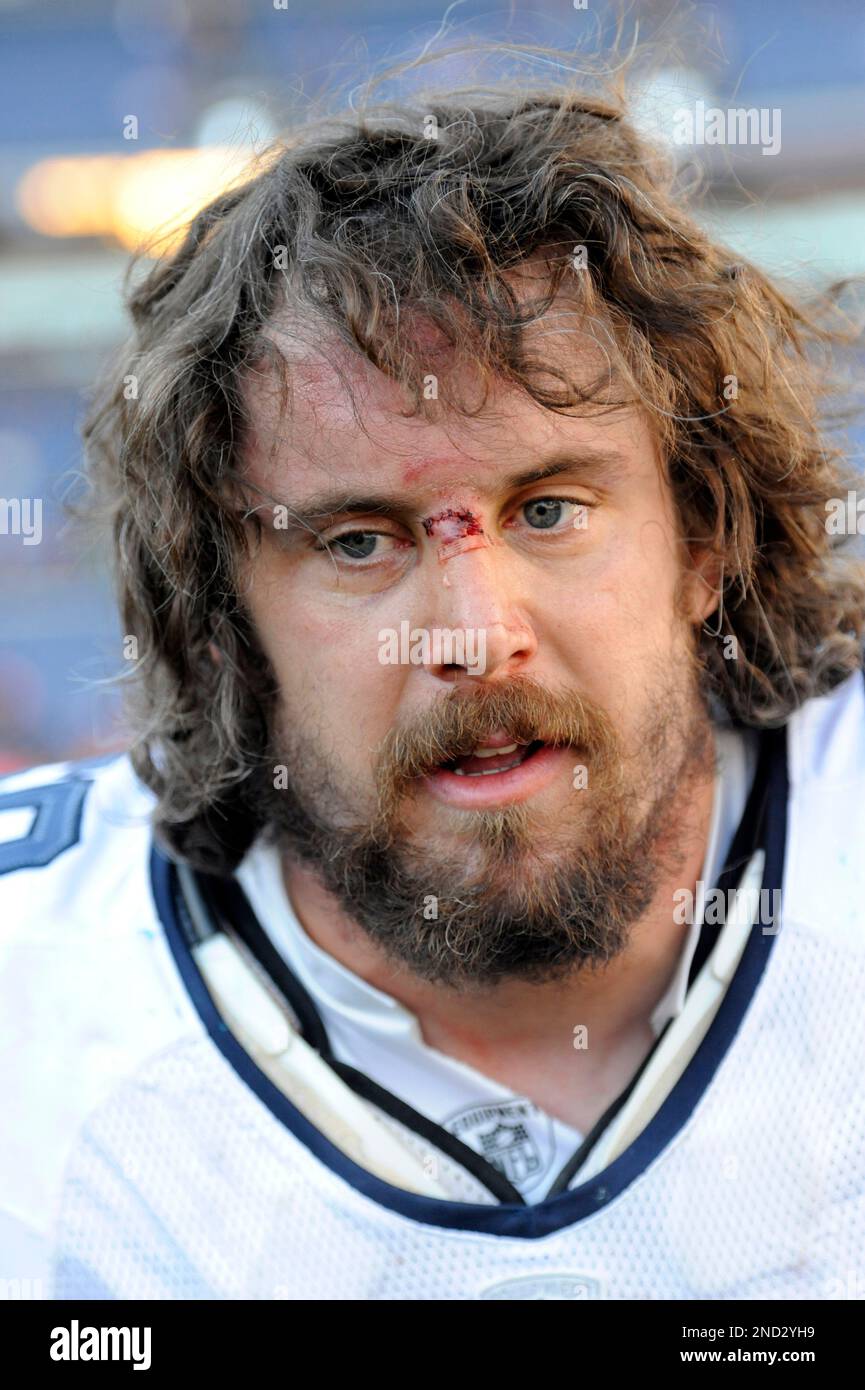 Seattle Seahawks guard Ben Hamilton has a bloodied nose as he leaves ...