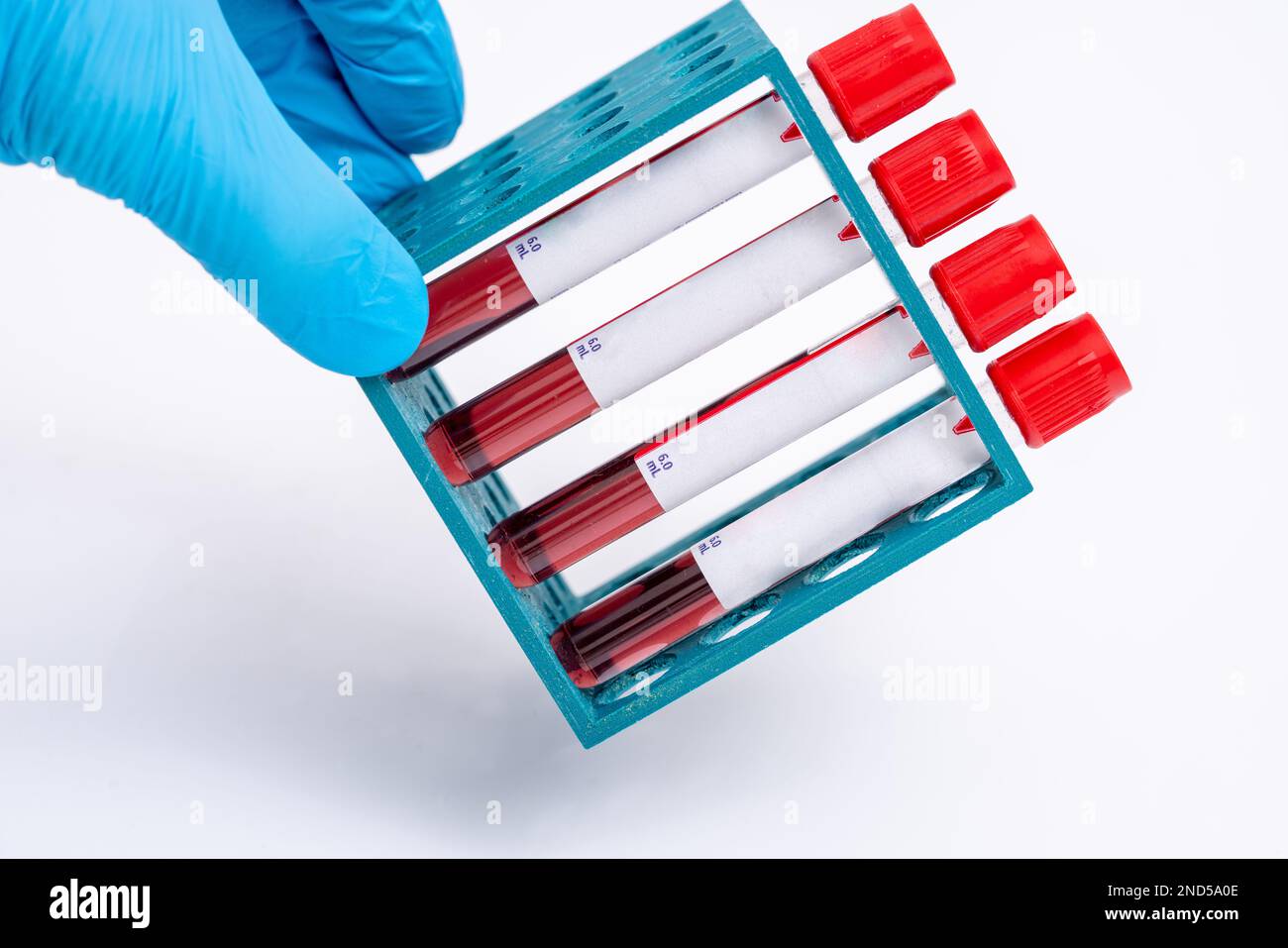 rack with test tubes of blood samples for biochemical analysis in a ...