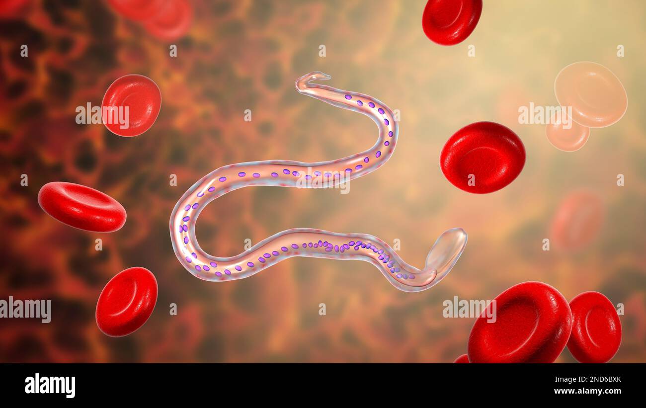 Wuchereria bancrofti parasite hi-res stock photography and images - Alamy