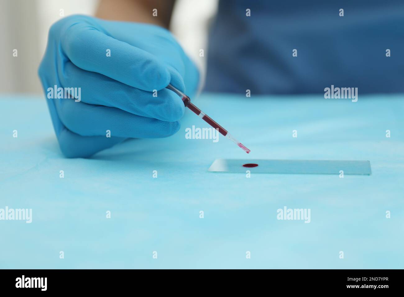 Blood sample finger coronavirus hi-res stock photography and images - Alamy