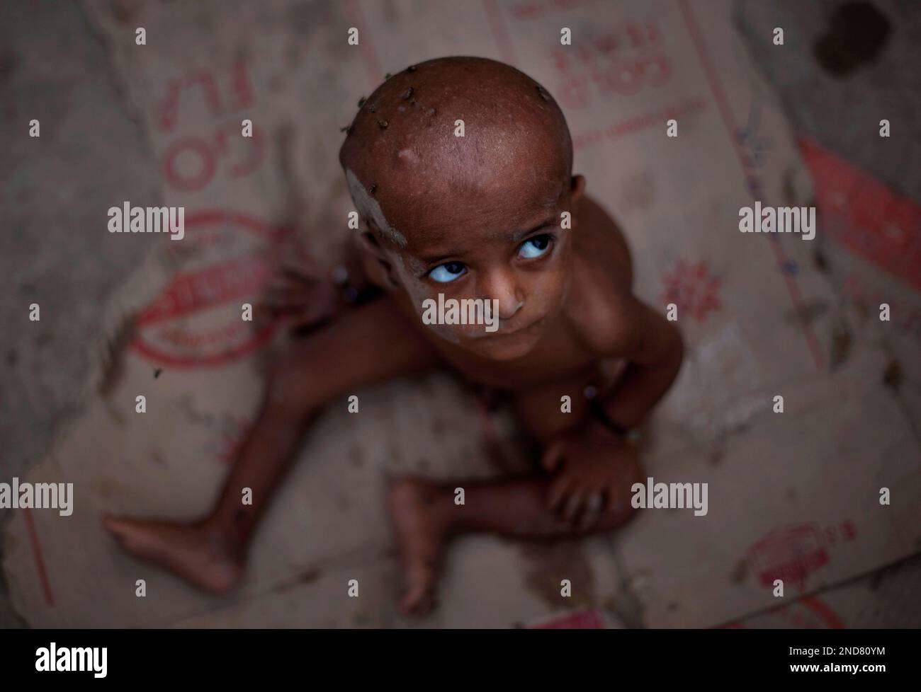 A malnourished Pakistani boy whose family was displaced by floods sits ...