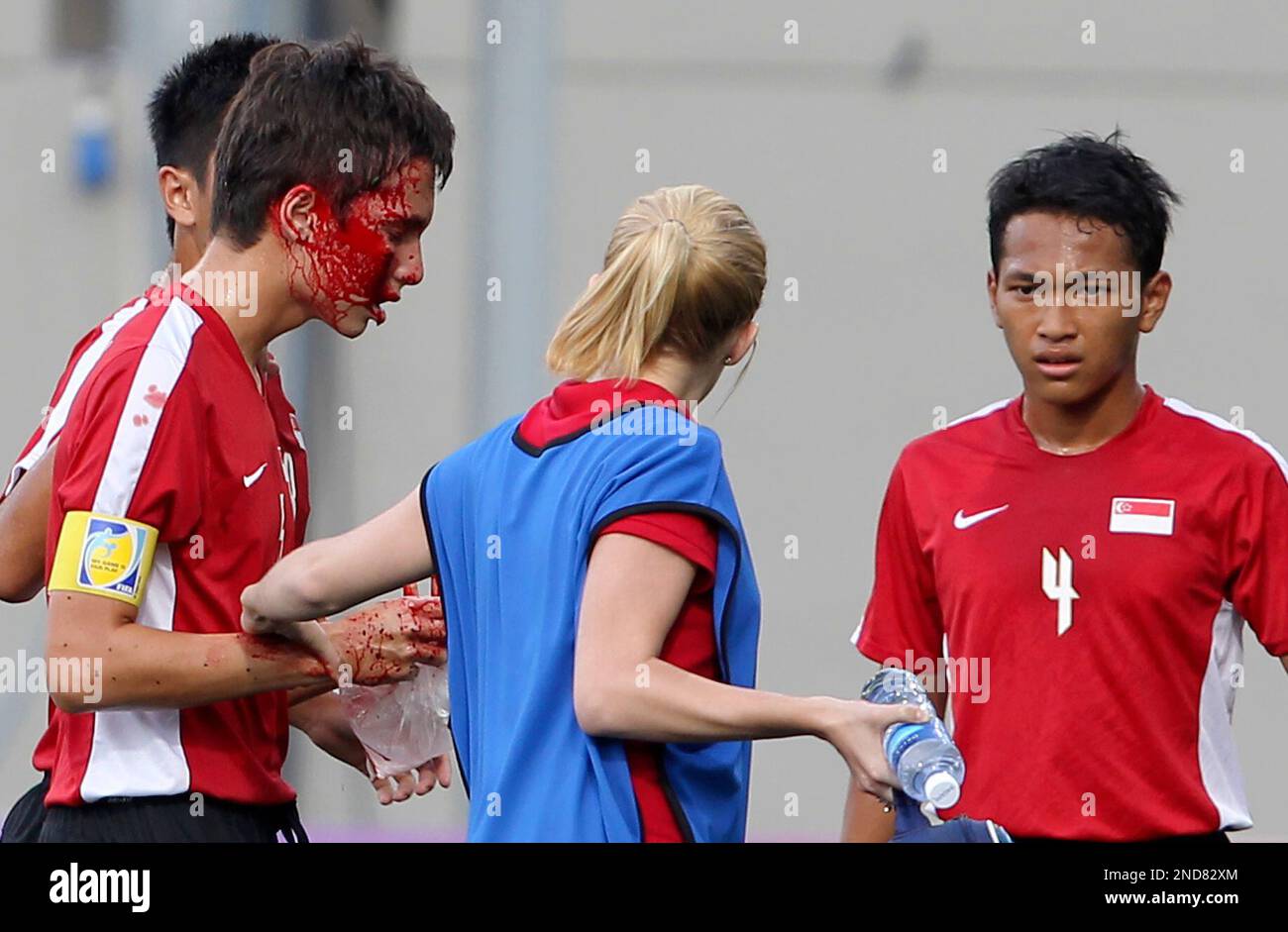 Singapore's team captain Jeffrey Lightfoot is led away after suffering ...