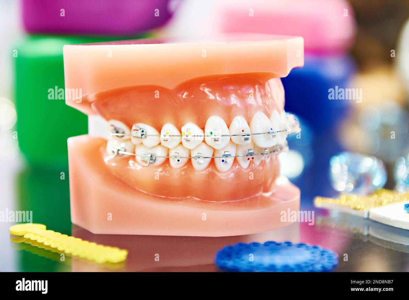 Dental model of the human jaw with teeth and braces Stock Photo - Alamy