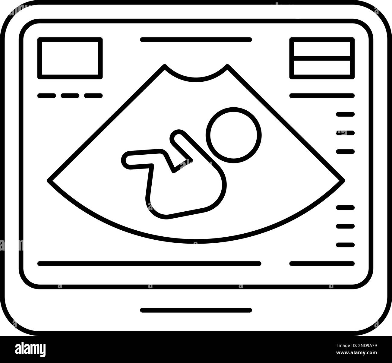 Ultrasound fetus Black and White Stock Photos & Images - Alamy