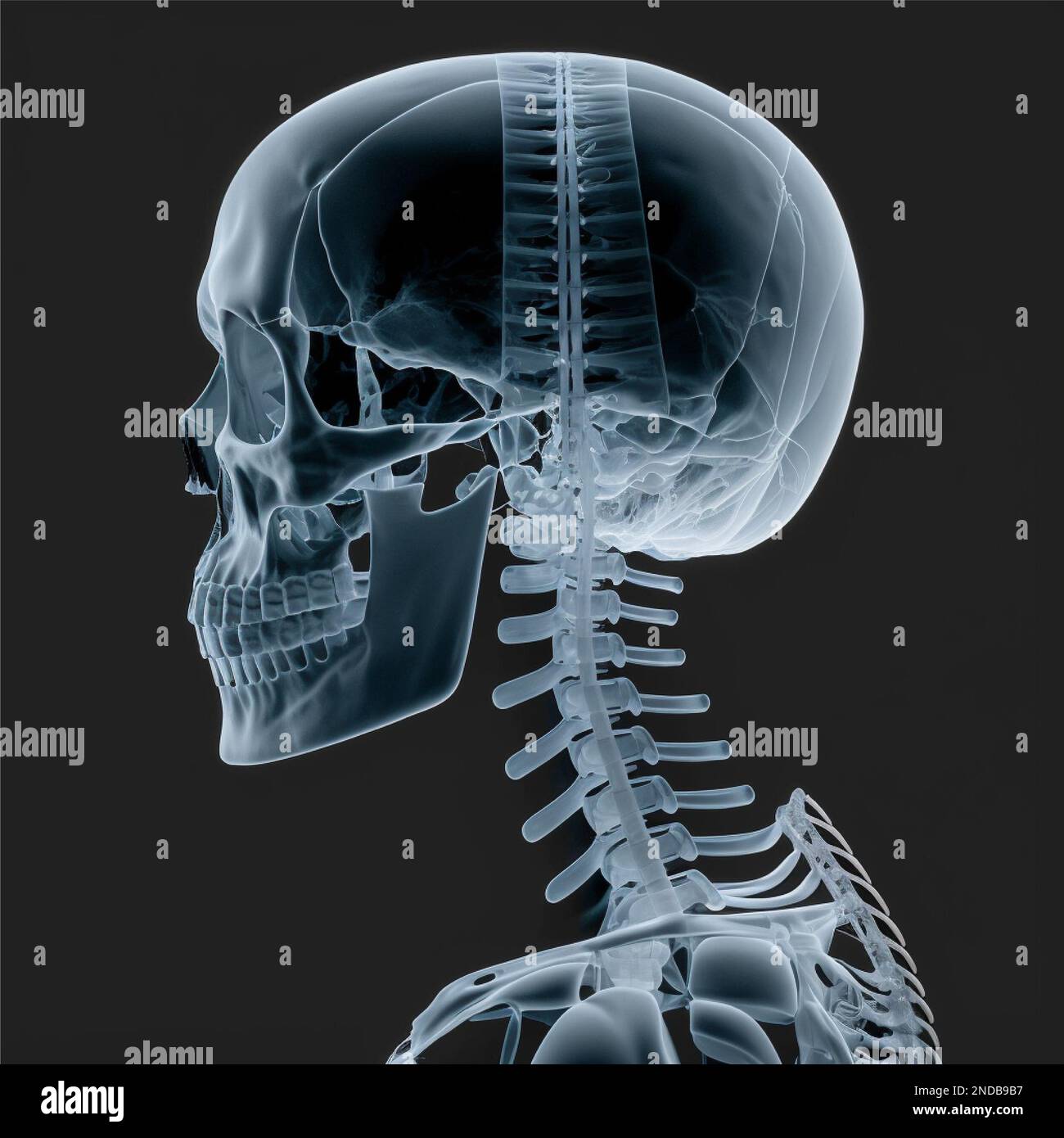 Film x-ray skull and cervical spine lateral view eps 10 Stock Photo - Alamy