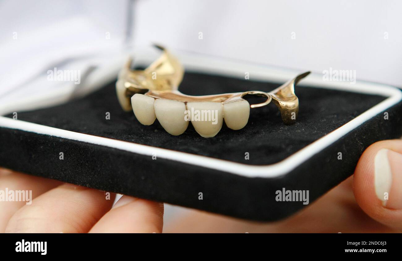 Sarah Prior holds a partial set of dentures used by former British ...
