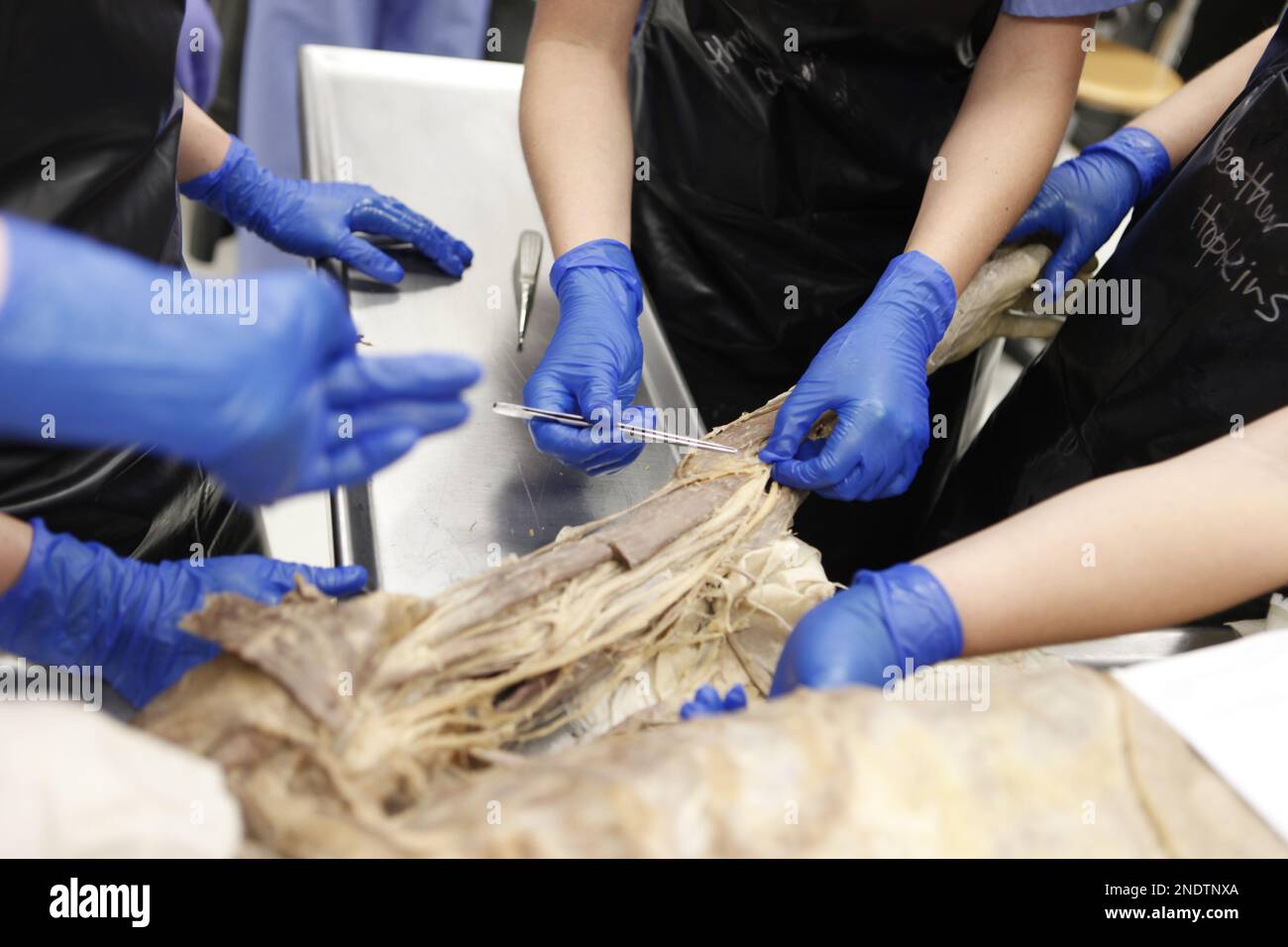 Gross Medical Pictures