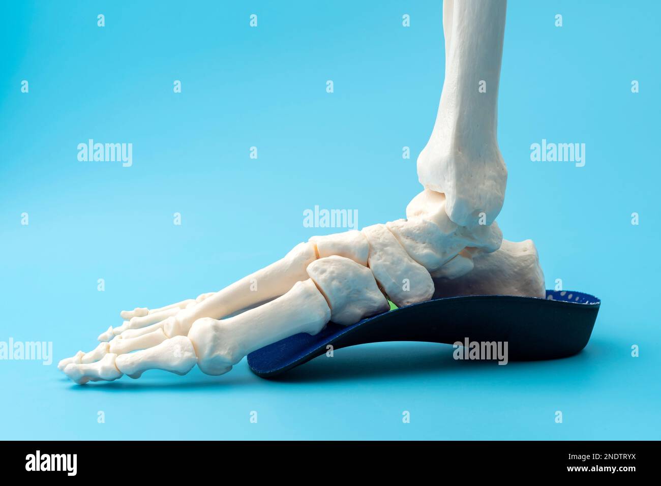 Anatomical model of the bones of the human foot wearing an orthopedic ...