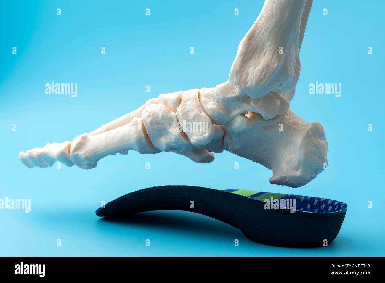 Anatomical model of the bones of the human foot wearing an orthopedic insole concept for ...