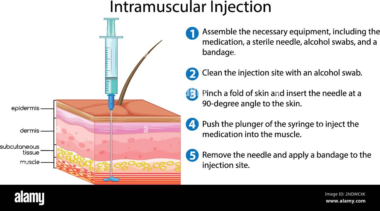 Intramuscular Injection with explanation illustration Stock Vector ...