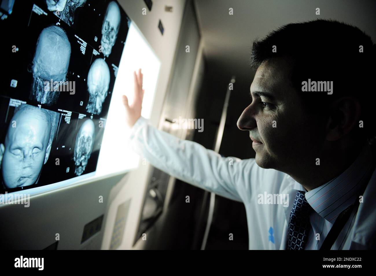Spanish Dr. Joan Pere Barret poses for a portrait in front of Magnetic ...