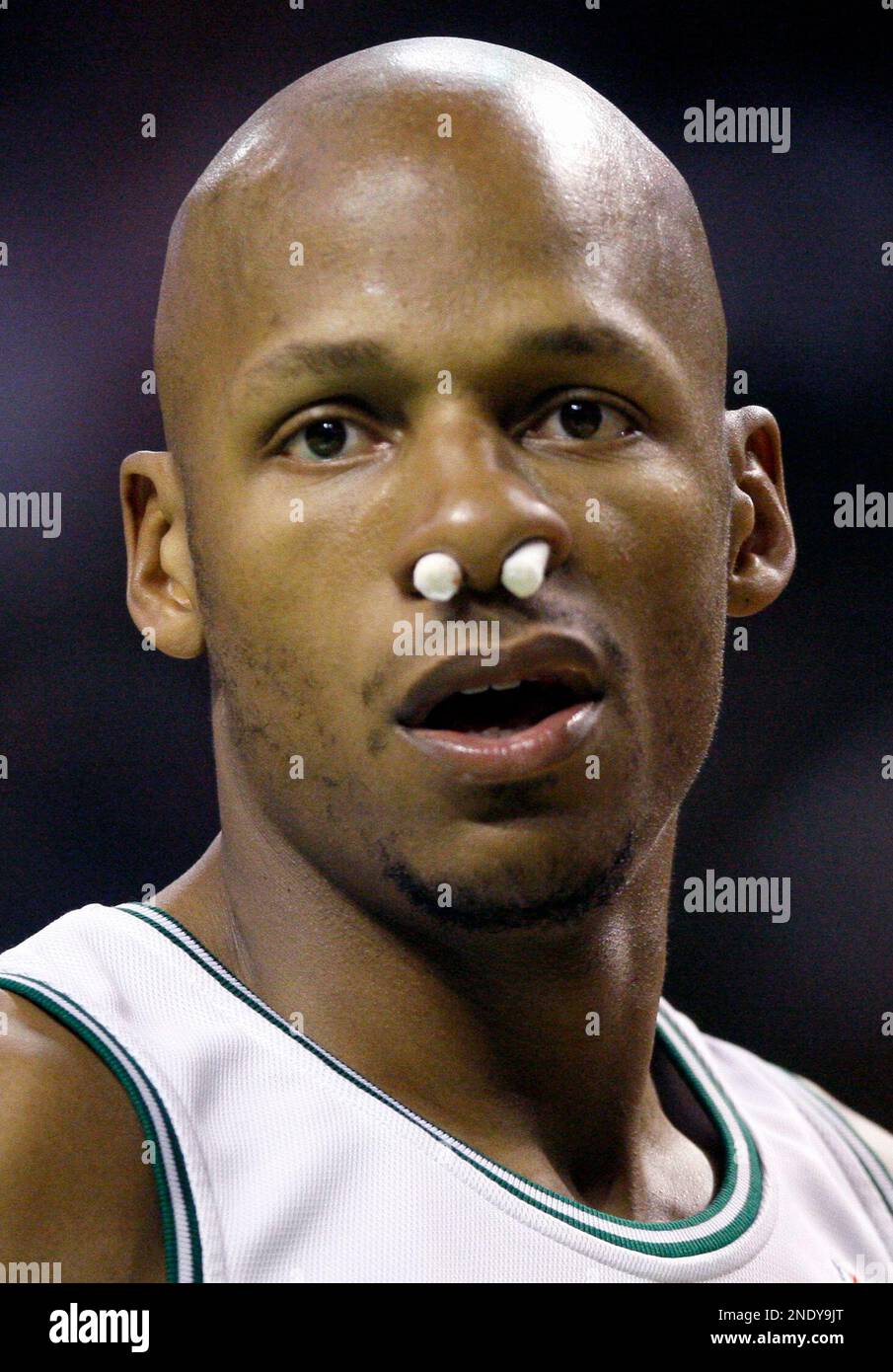 Boston Celtics guard Ray Allen has his bloody nose plugged while ...