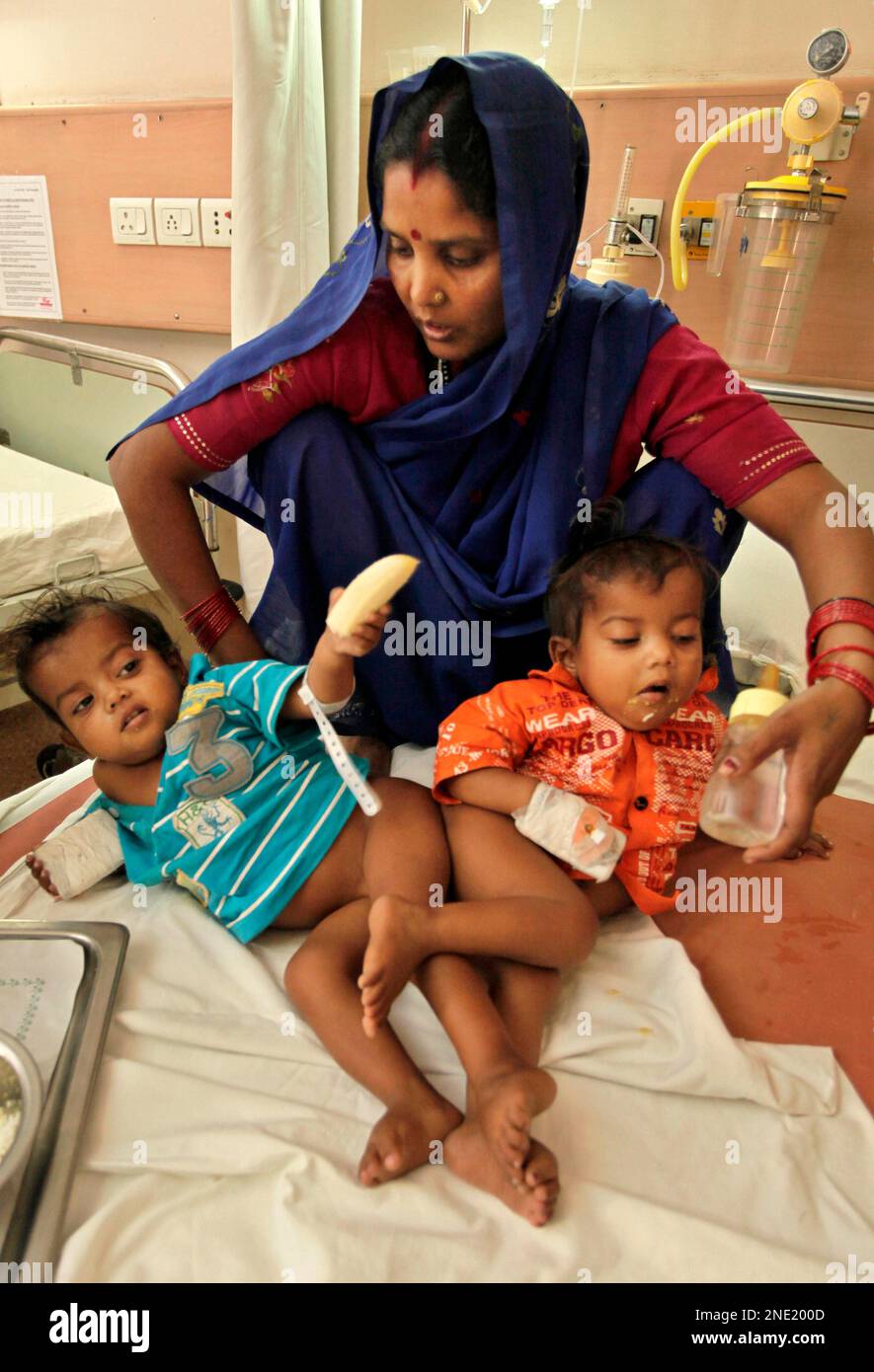 Mother Nirmala Devi feeds conjoined twins Geeta, orange dress, and ...