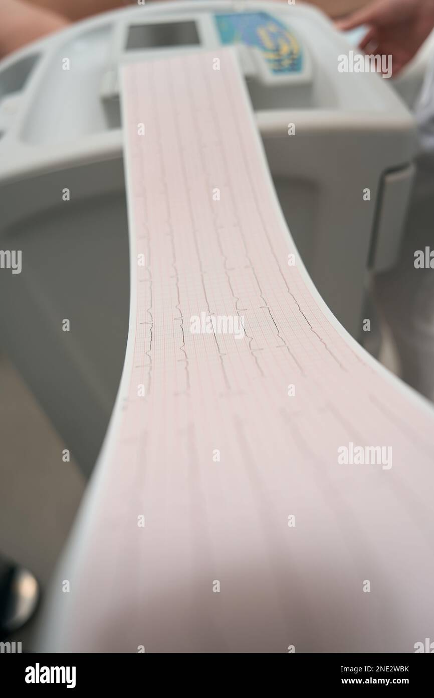 Detail image of diagnoses heartbeat in hospital Stock Photo - Alamy