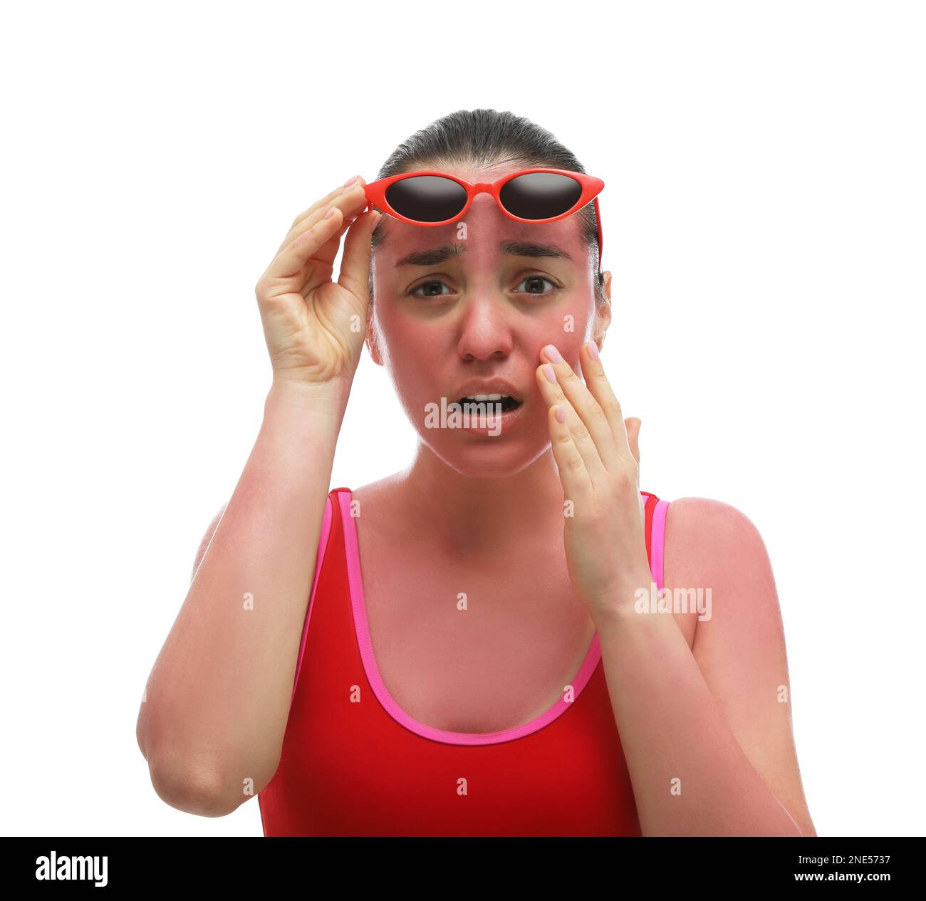 Woman with sunburned skin on white background Stock Photo - Alamy