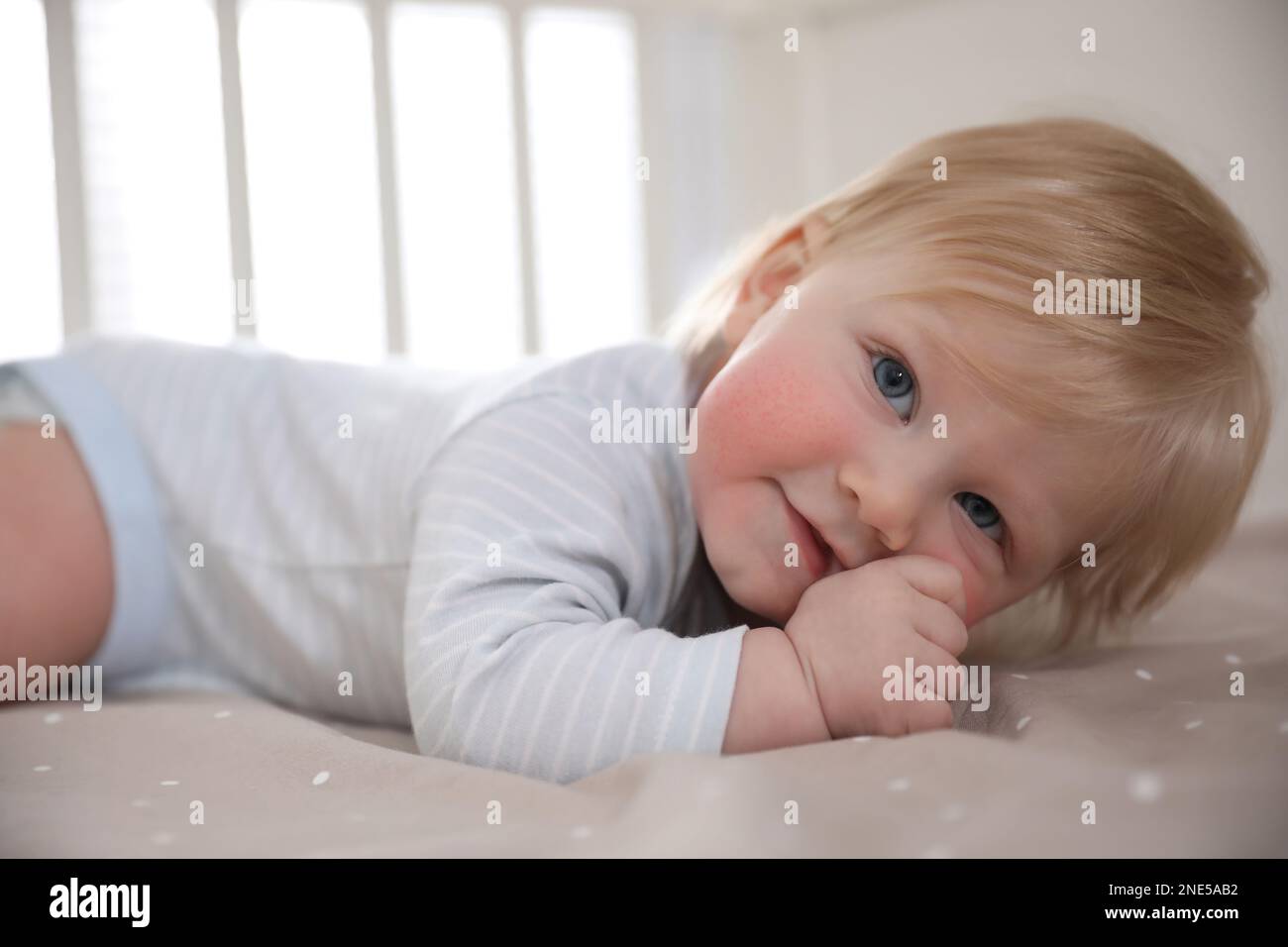 Cute little baby with allergy symptoms on cheeks at home Stock Photo ...