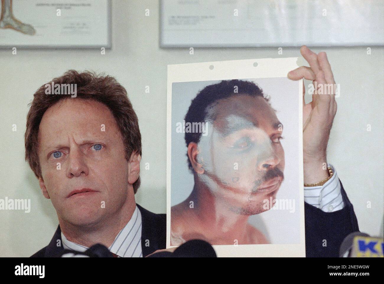Steven Lerman, attorney for Rodney King, displays a photo of his client ...