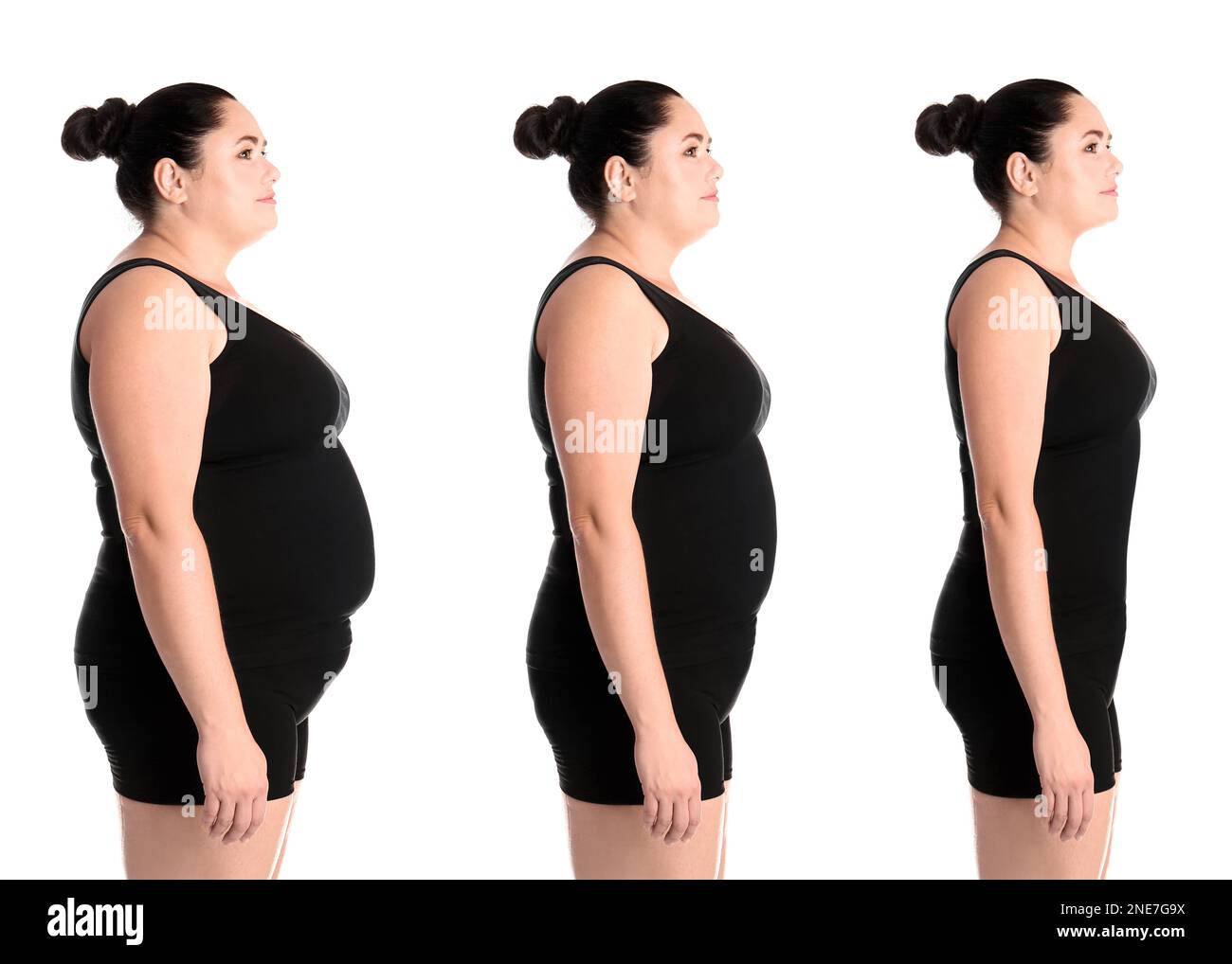 Woman before and after weight loss on white background, collage Stock ...