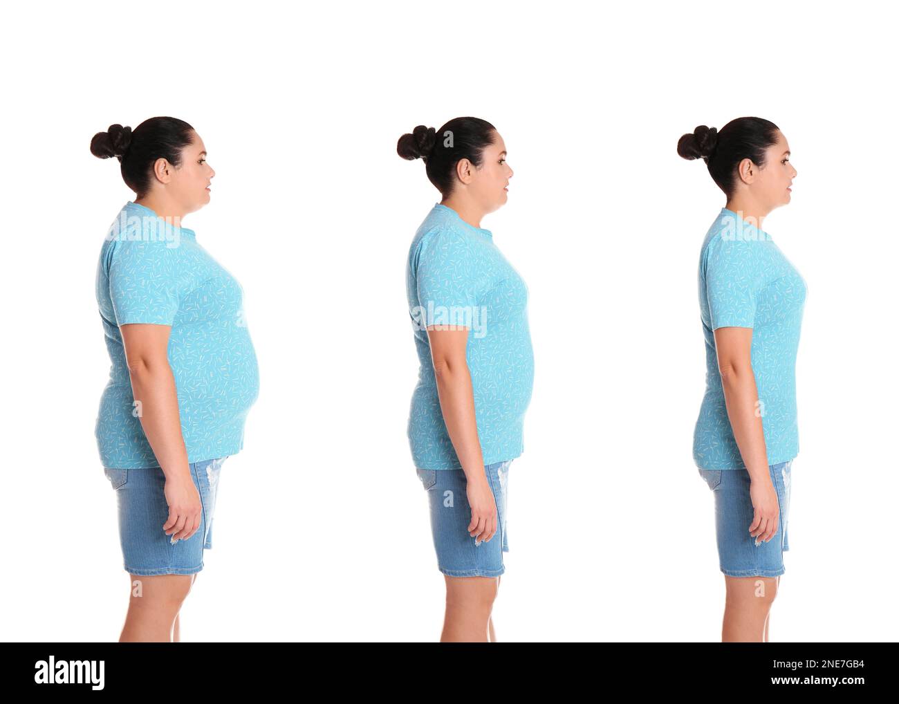 Woman before and after weight loss on white background, collage Stock ...