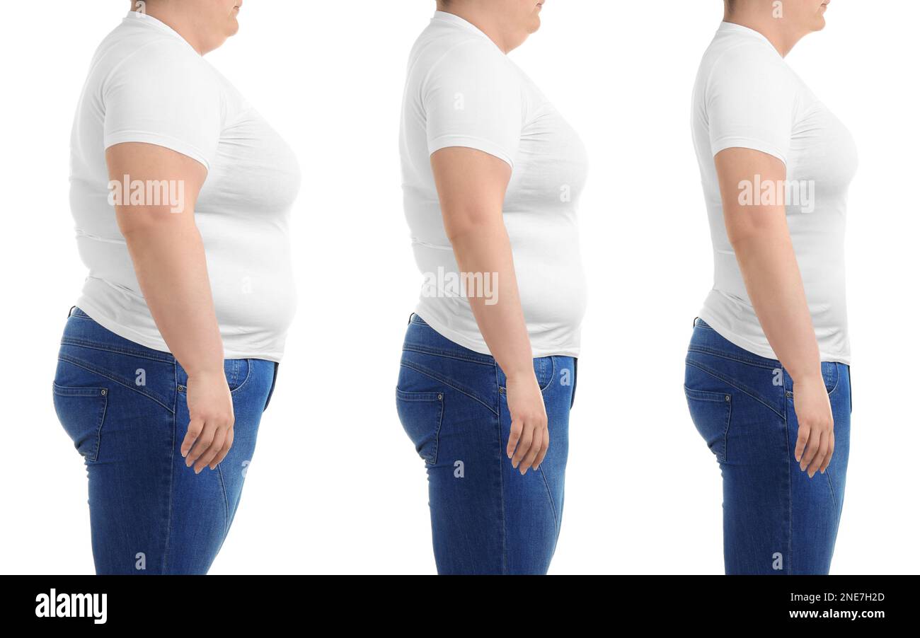 Woman before and after weight loss on white background, collage Stock ...