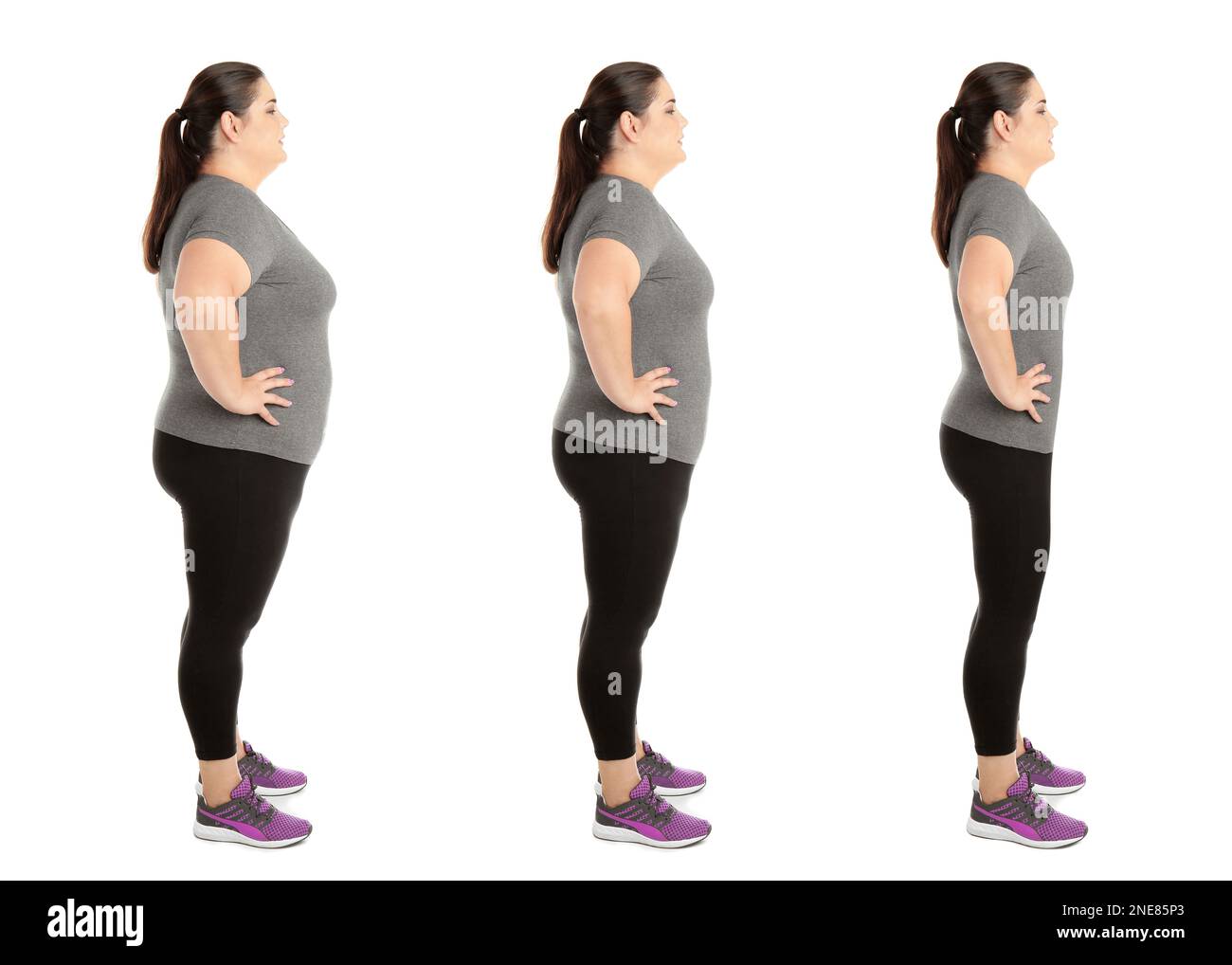 Woman before and after weight loss on white background, collage Stock ...