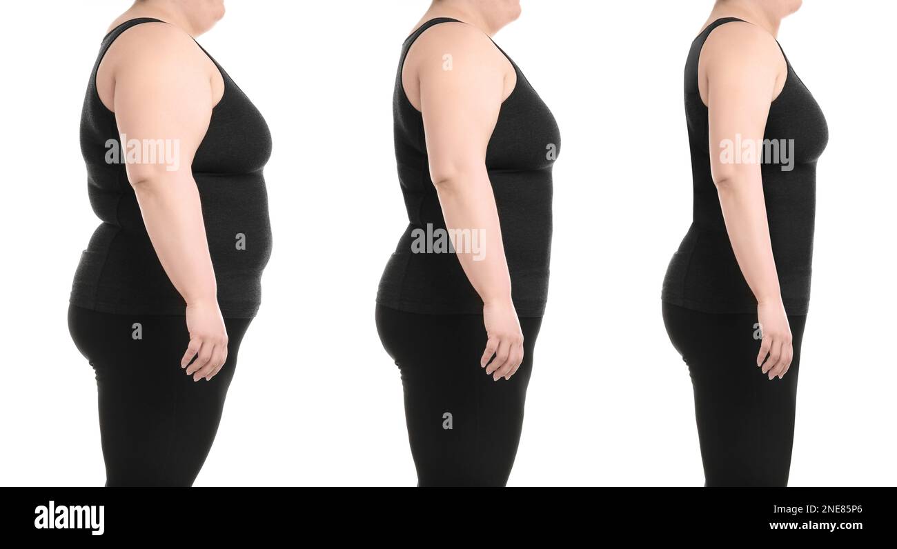 Woman before and after weight loss on white background, collage Stock ...