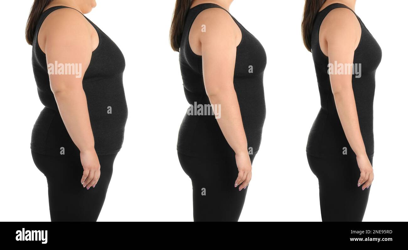 Woman before and after weight loss on white background, collage Stock ...