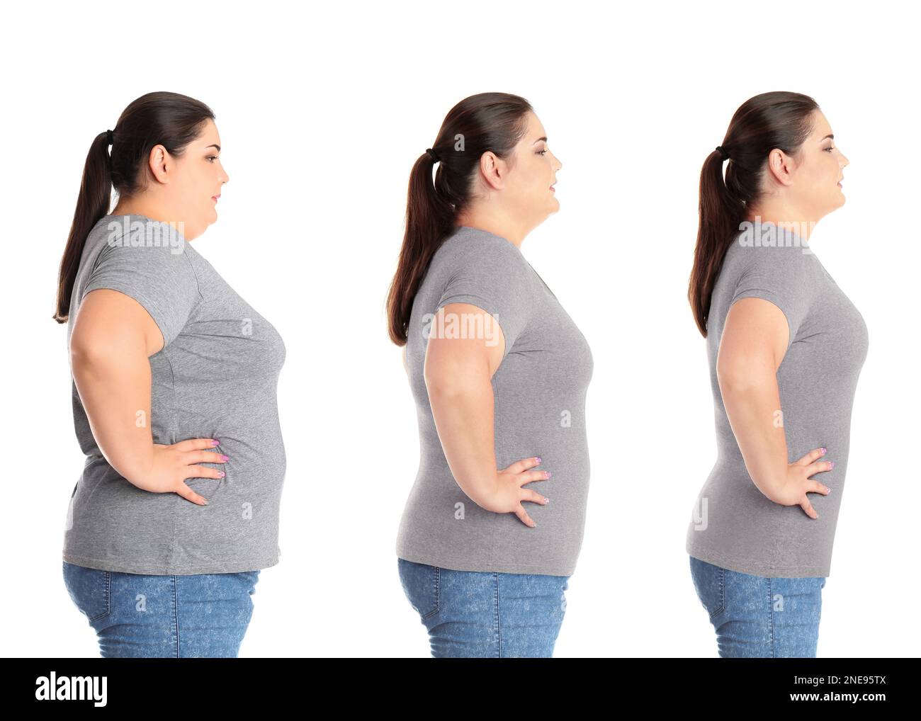 Woman before and after weight loss on white background, collage Stock ...