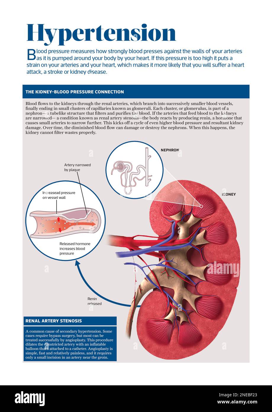 Infographic about hypertension and about the connection between the ...