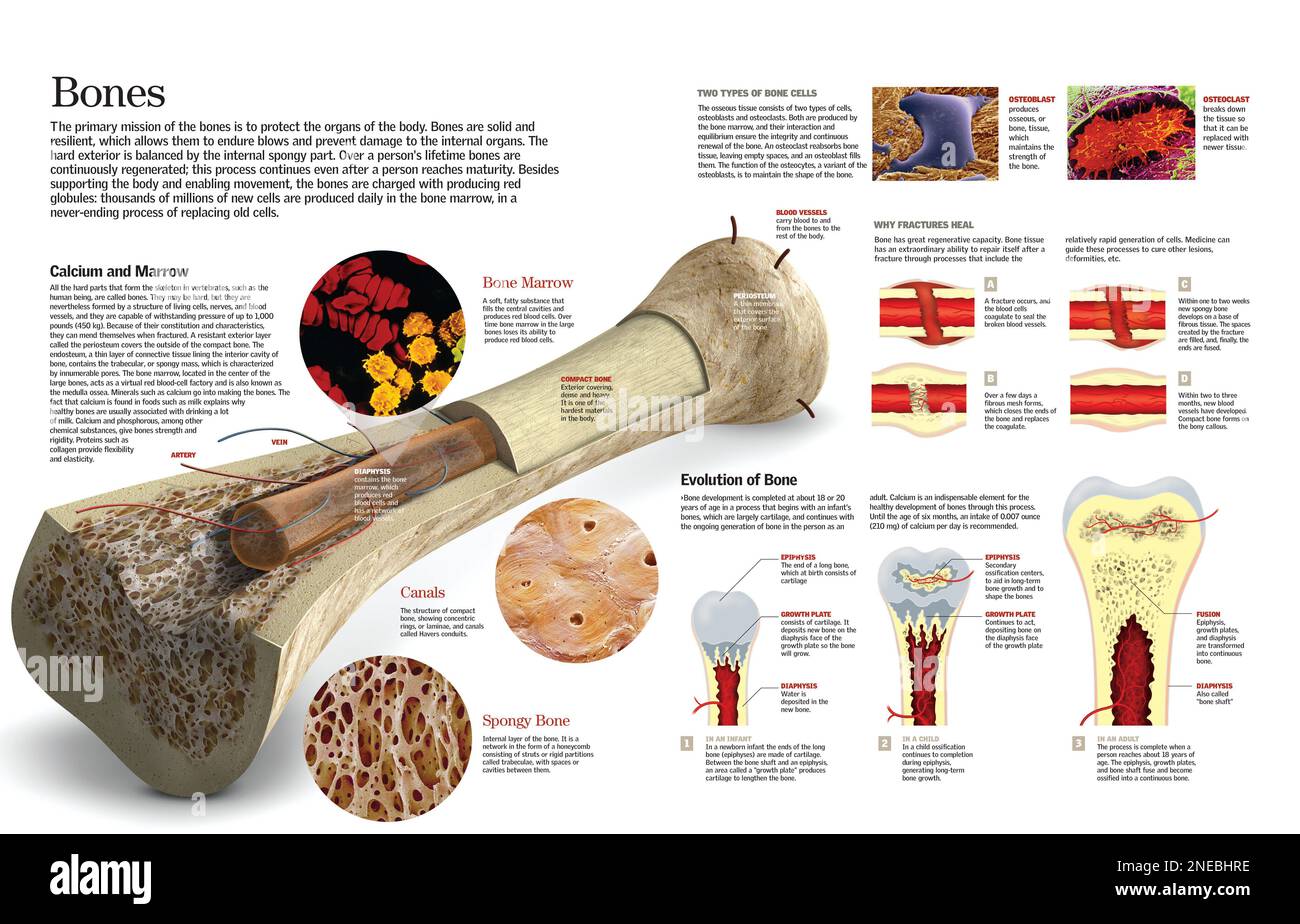 Bone regenerations hi-res stock photography and images - Alamy