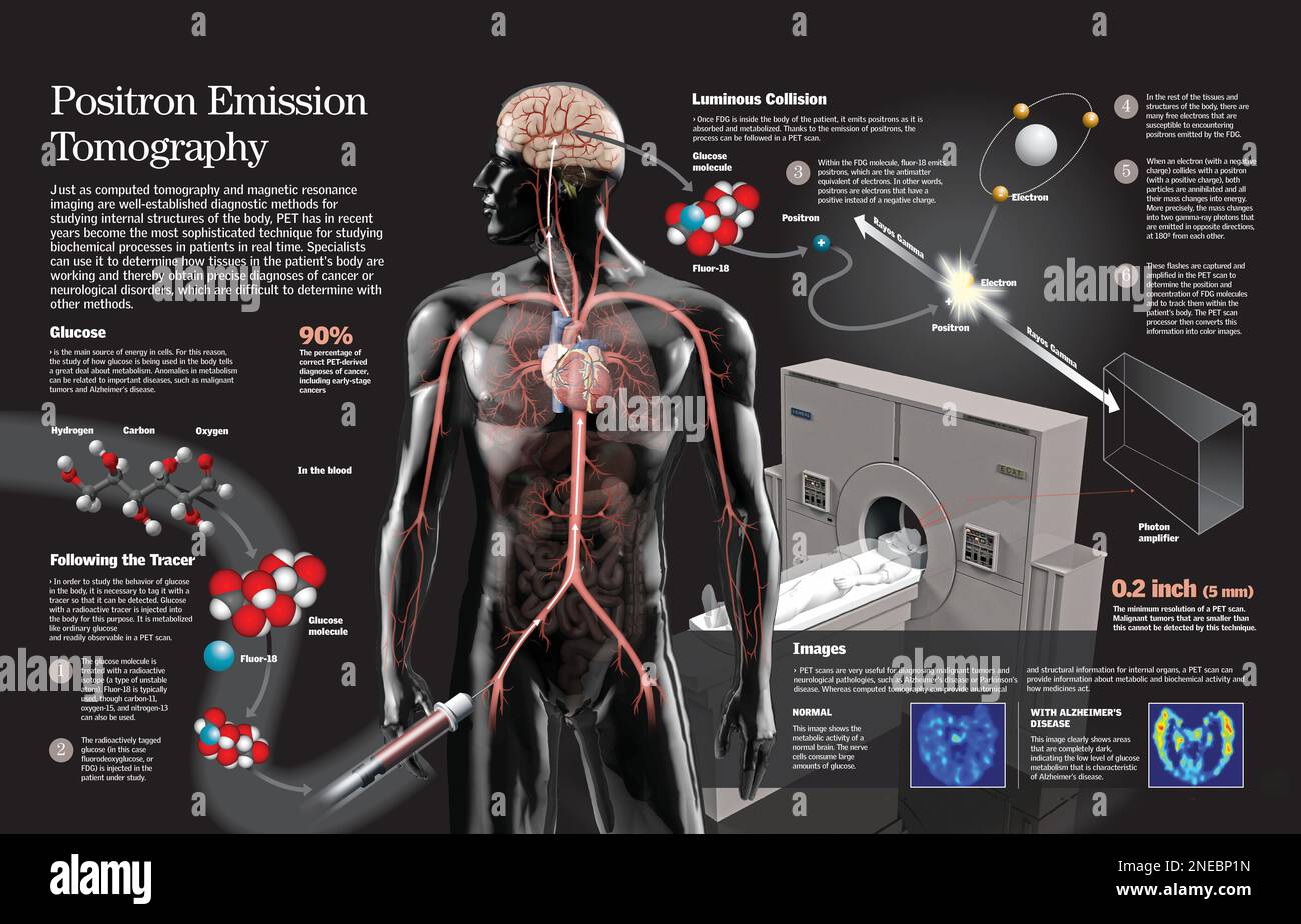 Infographic of the process of conducting a positron emission tomography ...