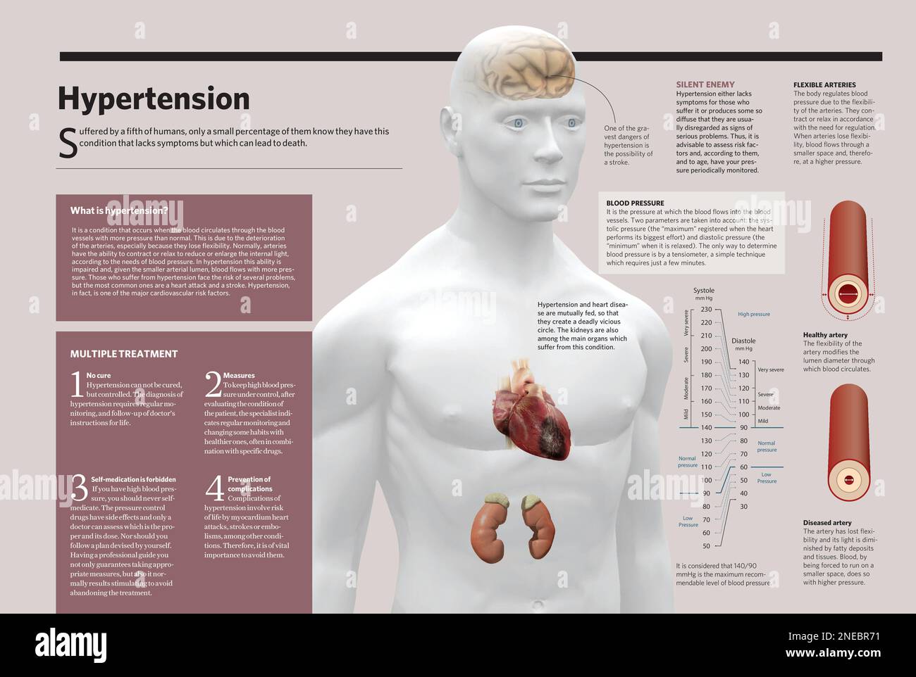 Infographic about high blood pressure, a chronic disease characterized ...