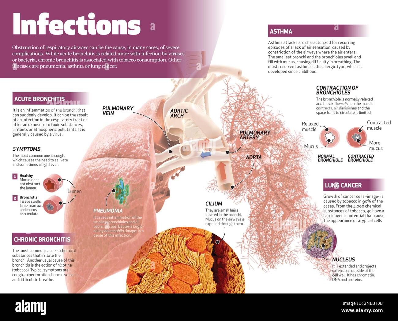 Aorta arterie hi-res stock photography and images - Alamy