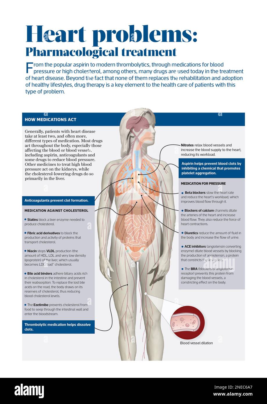 Infographic that shows where and how medication affects heart diseases ...