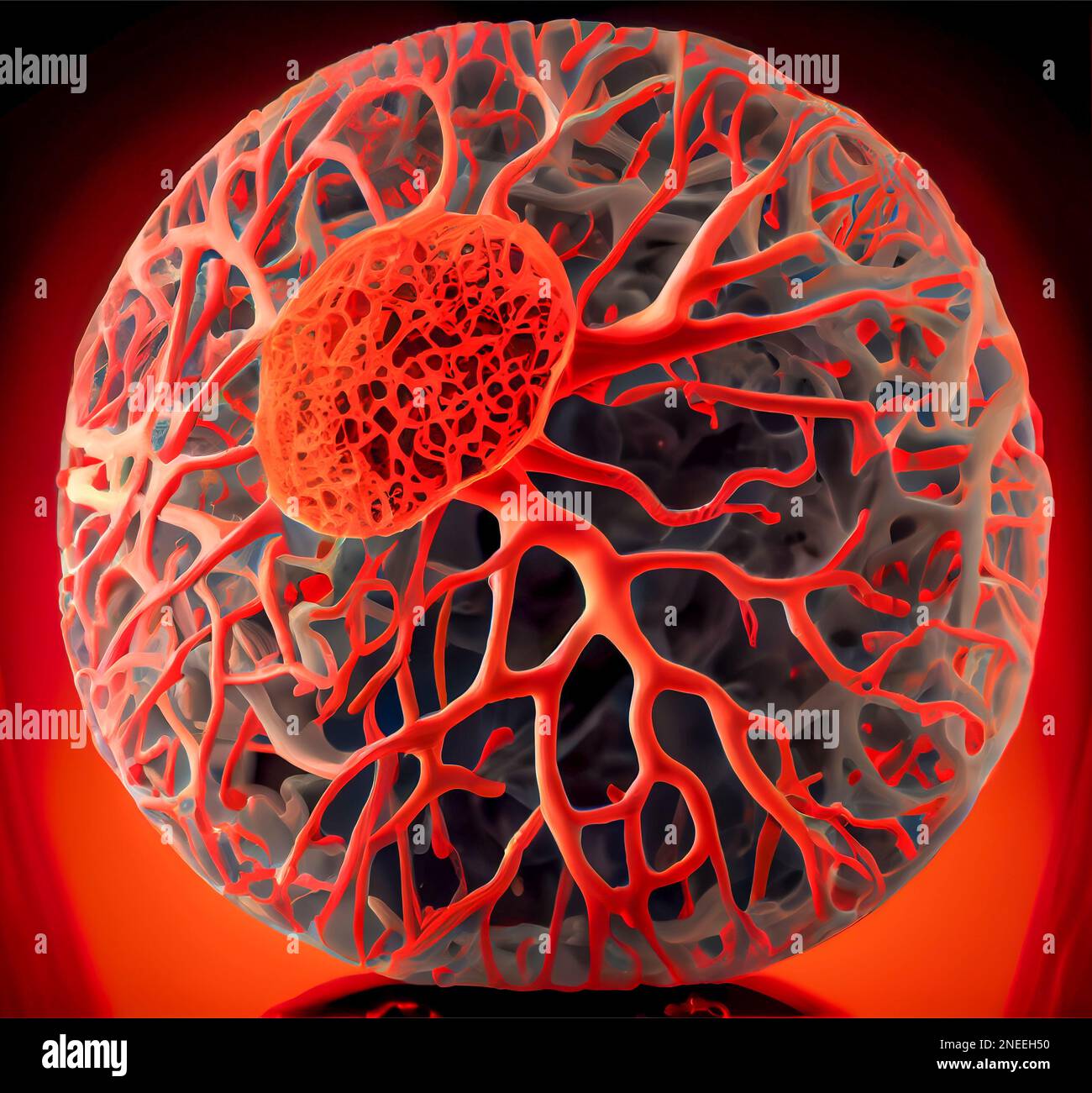 Prostate lymphoma hi-res stock photography and images - Alamy