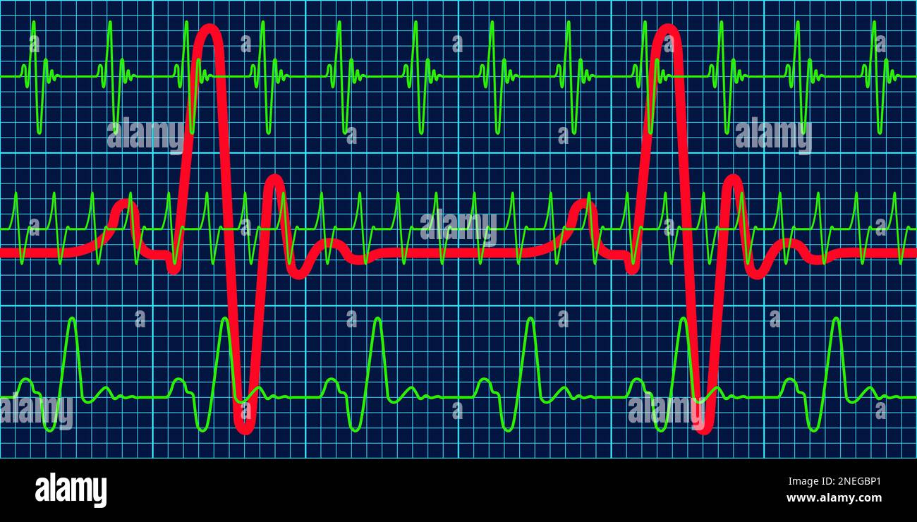 Illustration of the abstract cardiogram charts set Stock Vector Image ...