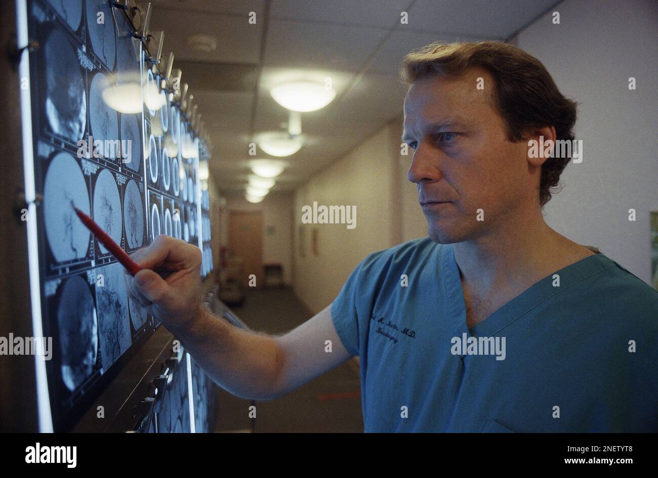 Dr. Neil Martin, professor of neurosurgery and a neurovascular ...