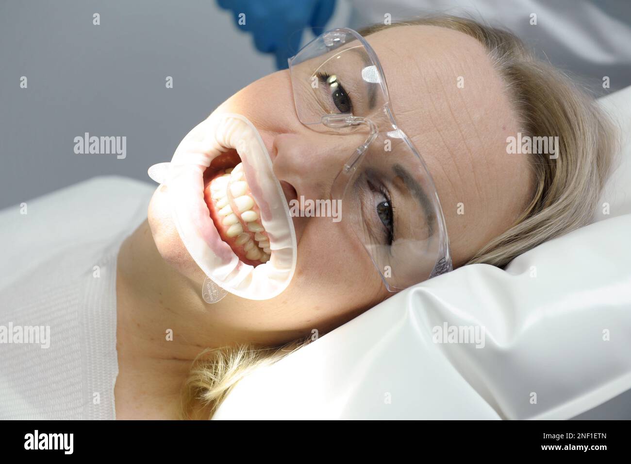 Retractors hi-res stock photography and images - Alamy