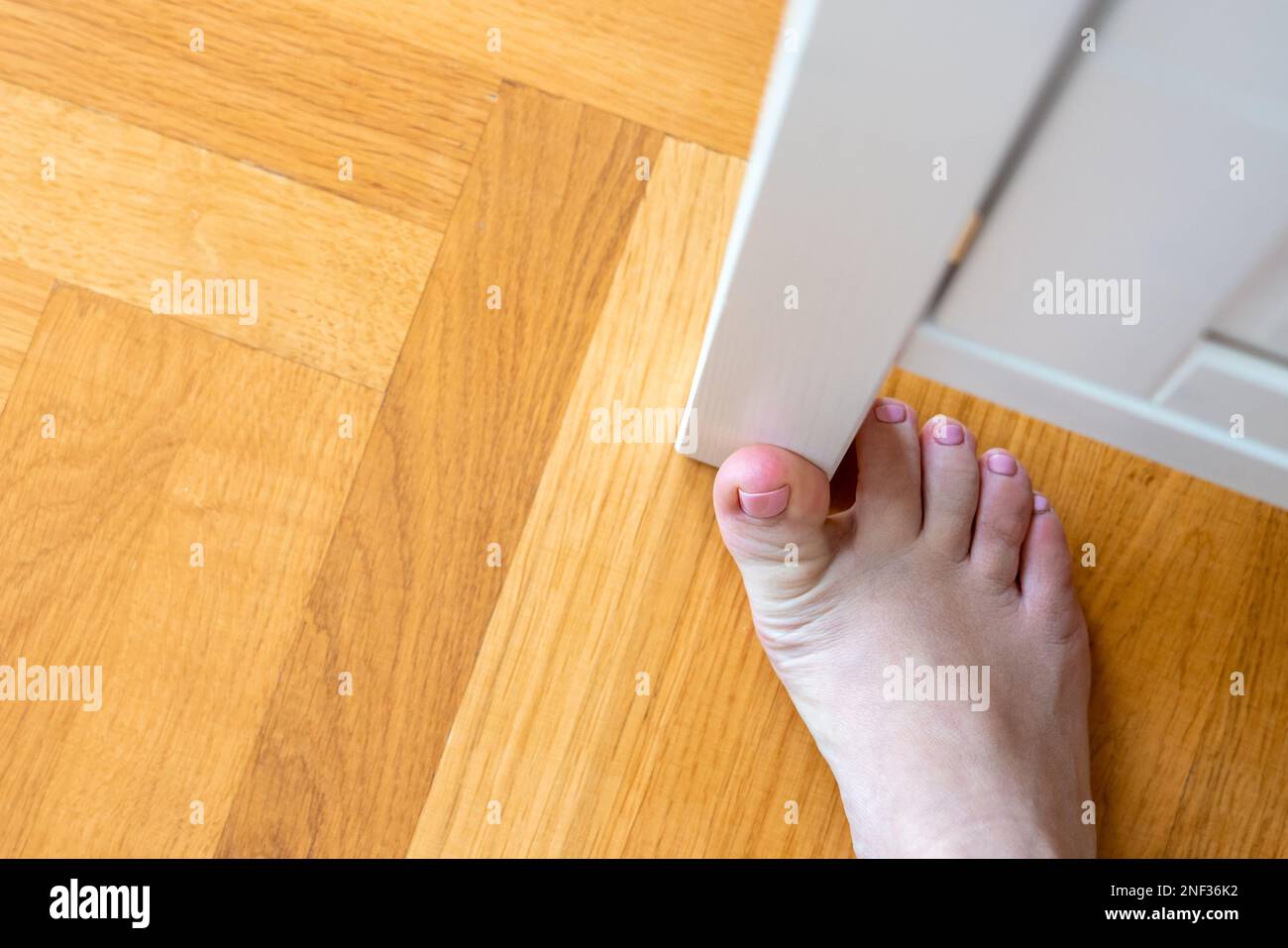 Woman hit furniture with big toe. Incident at home. Injury of foot ...