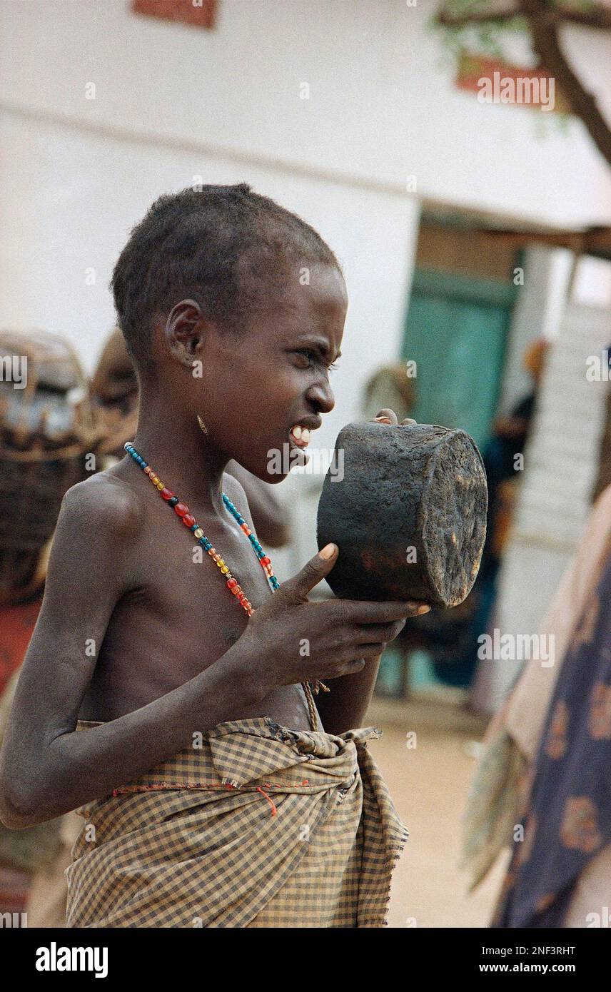 Somalia boy starving shown August 17, 1992 in Baidoa Somalia. (AP Photo ...