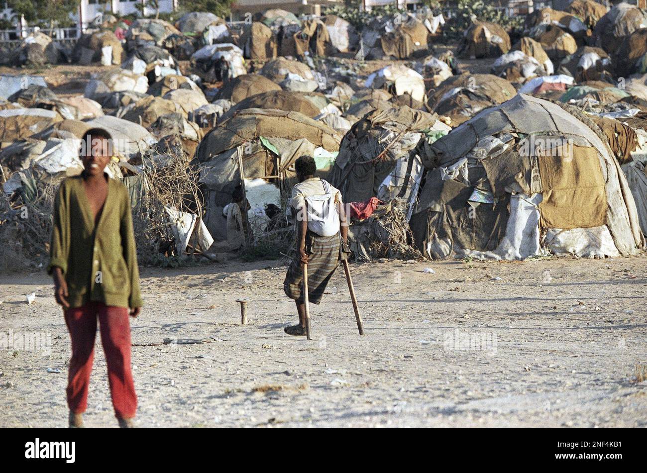 An civil war amputee walks to his hut in a squalid camp for displaced ...