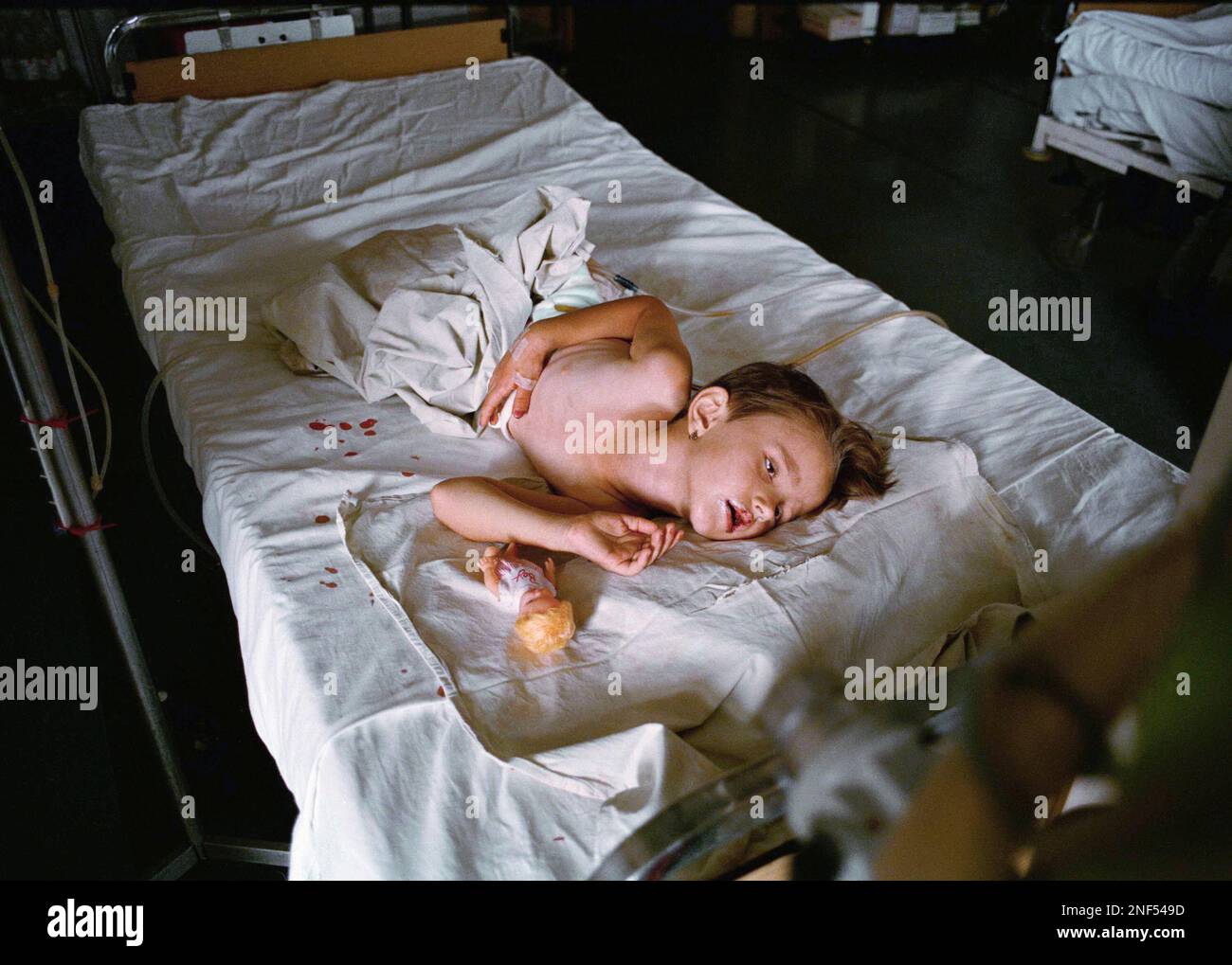 Five-year-old Irma Hadzimuratovic lies on blood-stained sheets in ...