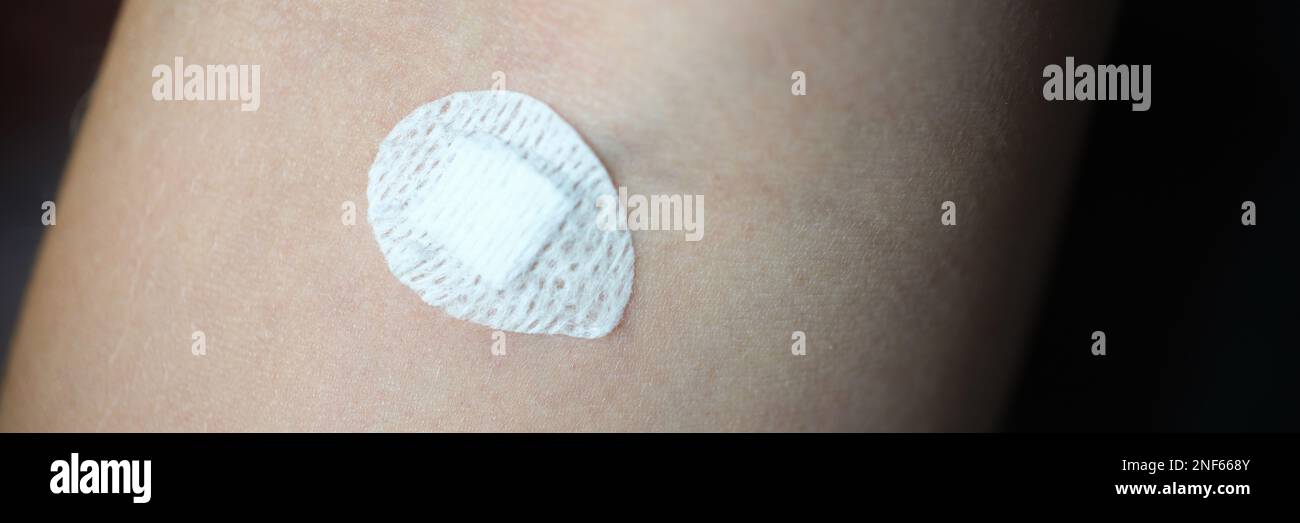 Small round patch stuck in place intravenous injection on forearm ...