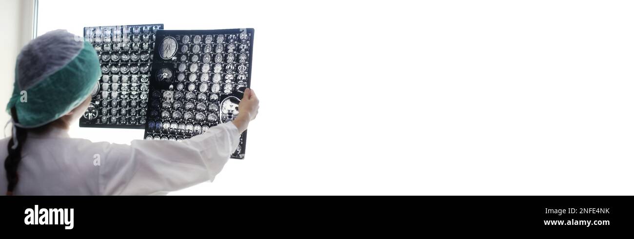 isolated poster with doctor holding a picture of a brain MRI workflow ...