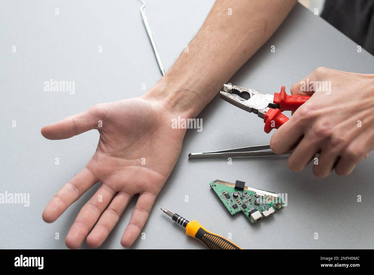 Hand with implantation of micro chip. X-Ray view close-up. Chipization ...